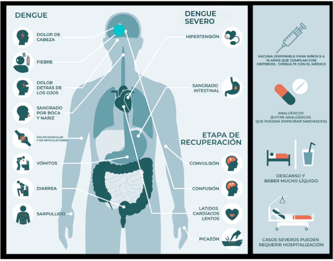 Síntomas del Dengue